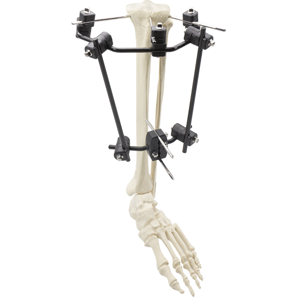 China 2018 New Style Trauma Distal Fibular Locking Plate - Φ8.0 Series ...